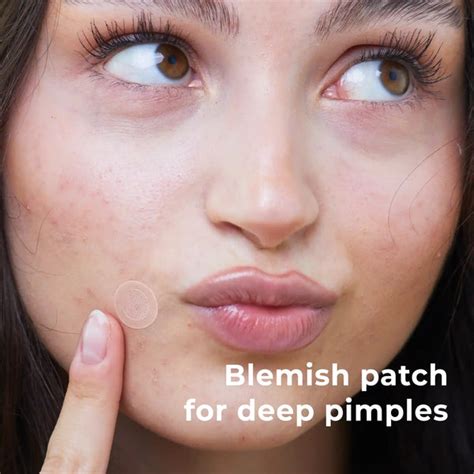 Wow Patch Blemish Patch Kit Omma Cosmetics