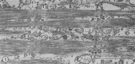 Electron Micrograph Of The Longitudinal Section Of A Glycerinated