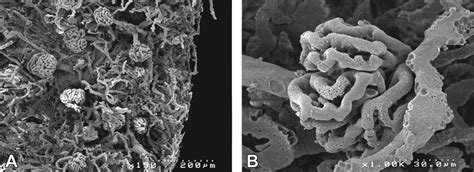 Scanning Electron Microscopy Micrographs Of Vascular Corrosion Casts Download Scientific