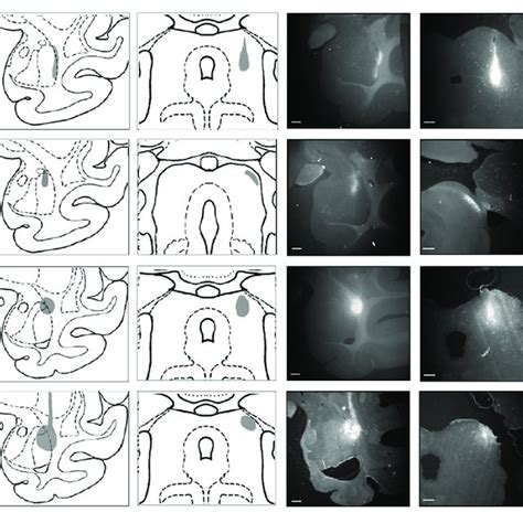 tracer injections across cases download table