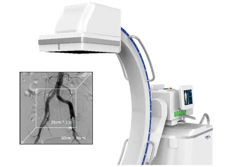 Mobile Interventional C Arm For Ercp Enhancing Precision With Real