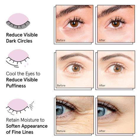 Under Eye Masks For Puffiness And Wrinkles By Grace And Stella Grace