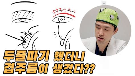 실패 없는 두줄따기 수술 Youtube
