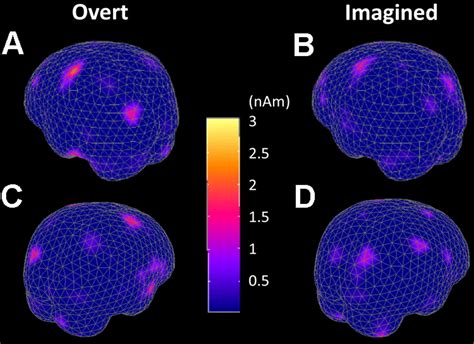 Decoding And Cortical Source Localization For Intended Movement Direction With Meg Journal Of
