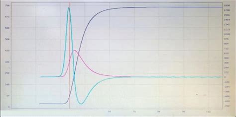 Clot Waveform Analysis Of Prolonged Activated Partial Indian