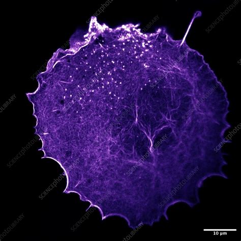 Fibroblast Like Cell Cytoskeleton Light Microscopy Stock Video Clip K014 8399 Science