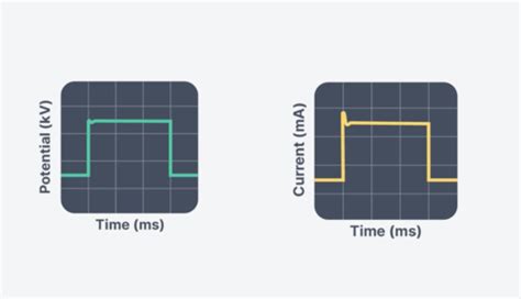 Waveform Flashcards Quizlet