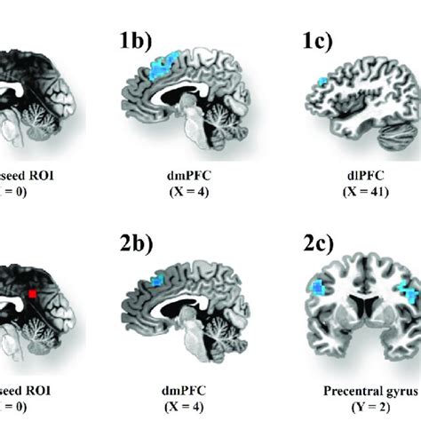 Sex Is Associated With The Ifc Of The Dmn Default Mode Network The Download Scientific