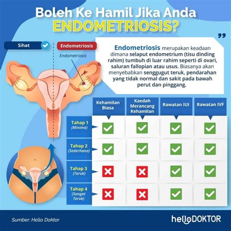 Apa Itu Endometriosis Ia Sejenis Penyakit Wanita Yang Anda Perlu Peka