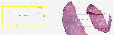 four ways to add annotations to re using python real data digital pathology blog