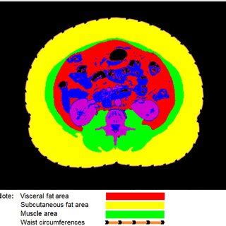 Subject Selection Diagram CT Indicates Computed Tomography Download Scientific Diagram
