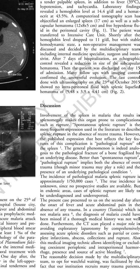 Ct Scan Findings At The Admission Download Scientific Diagram