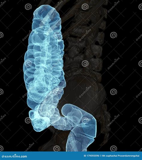 Ct Colonography Or Ct Scan Of Colon 3d Rendering Image Lateral View Stock Illustration