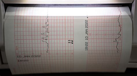 What Are The Different Types Of Chart Recorders Recorders Charts And Pens