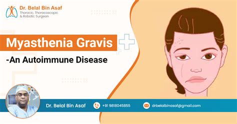 Lung Nodule Size Chart Dr Belal Bin Asaf
