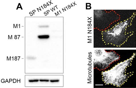 Truncating Mutations Of Spast Associated With Hereditary Spastic Paraplegia Indicate Greater