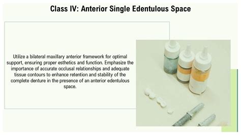 Denture Kennedy Classification Ppt Summary Acp Denture Kennedy Classification Ppt Summary Acp