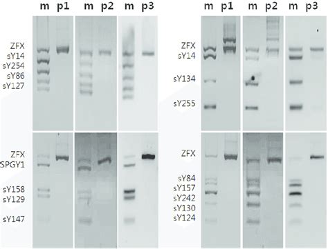 Multiplex Polymerase Chain Reaction Analysis Using Short Tandem Repeats Download Scientific