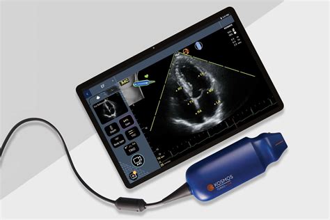 Clinical Benchmarking With Point Of Care Ultrasound Ai
