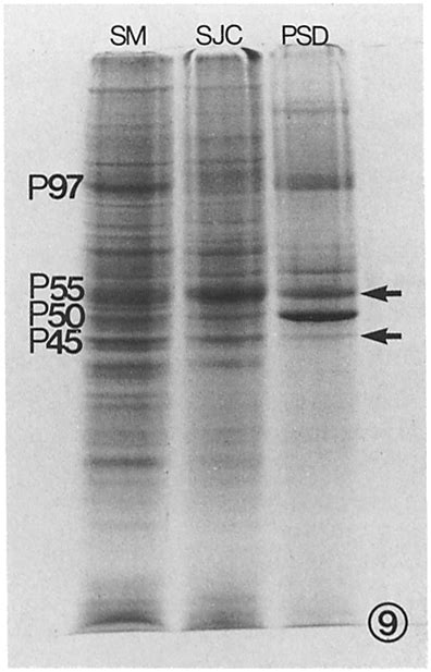 Electrophoretogram Comparing The Download Scientific Diagram