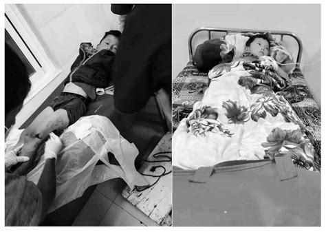 သိန္နီ ကွတ်ခိုင် တိုက်ပွဲကြား ကလေးအပါအဝင် အရပ်သား ၃ ဦး ကျည်ထိမှန် နေအိမ် ထိခိုက်ပျက်စီးဆုံးရ