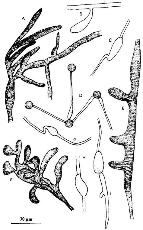 Non Identified Isolates Of Pythium A Dendroid Sporangium B D Download Scientific Diagram