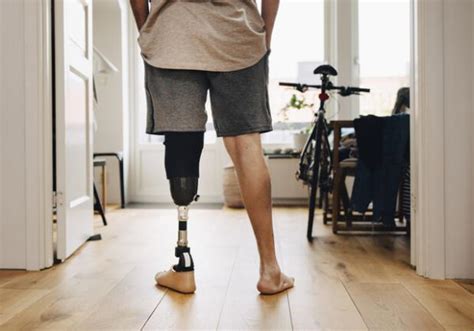 У МОЗ дали поради як спілкуватися з людьми без кінцівок чи з протезом Вечерний Киев новости