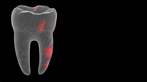 Premium Photo 3d Tooth Scan Tooth Scanning Interface Hud Tooth