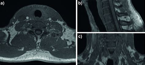 Figure 1 From Tracked 3d Ultrasound And Deep Neural Network Based Thyroid Segmentation Reduce