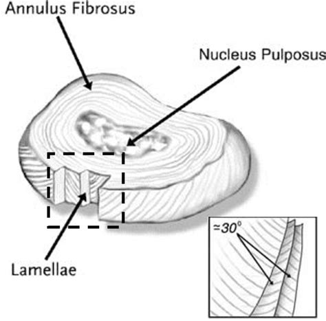 Figure 22 From The Development Of A Biomimetic Patch For Annulus Fibrosus Repair Semantic Scholar