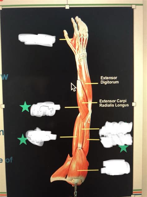 Arm Diagram Diagram Quizlet