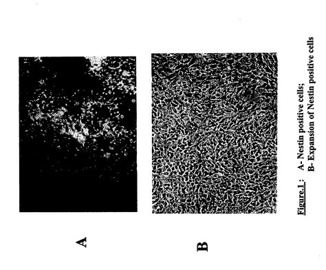 Derivation Of Terminally Differentiated Dopaminergic Neurons From Human Embryonic Stem Cells