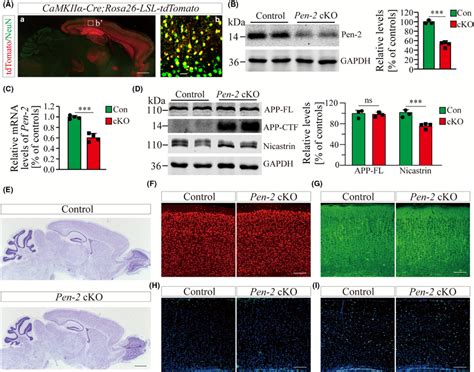 Molecular Characterization Of Forebrain Neuron‐specific Pen‐2 Cko Mice Download Scientific