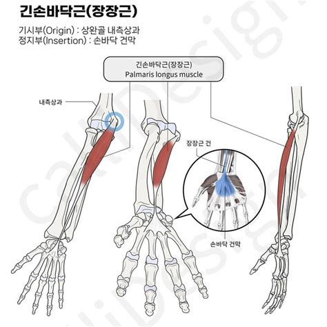 의학그림 메디컬 일러스트 Callidesign On Instagram 함께근육공부 시즌2 근육별기시정지 긴손바닥근장장근 기시정지 캘리디자인 메디컬일러스트와 함께 차근