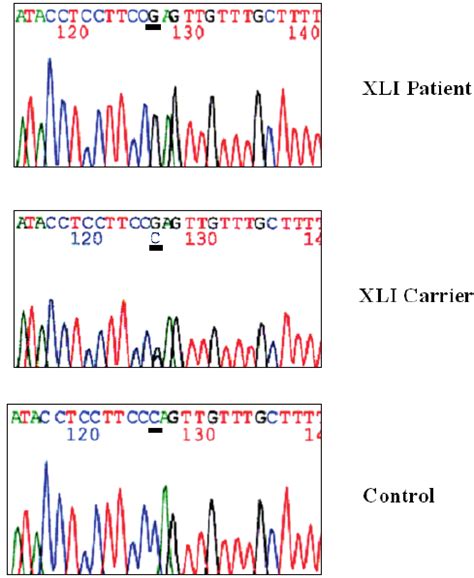 DNA Sequencing Analysis Identification Of The Point Mutation Within Download Scientific