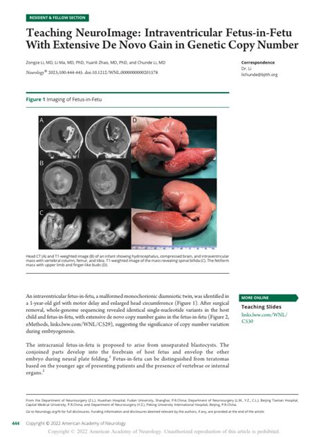 Li Et Al 2022 Teaching Neuroimage Intraventricular Fetus In Fetu With