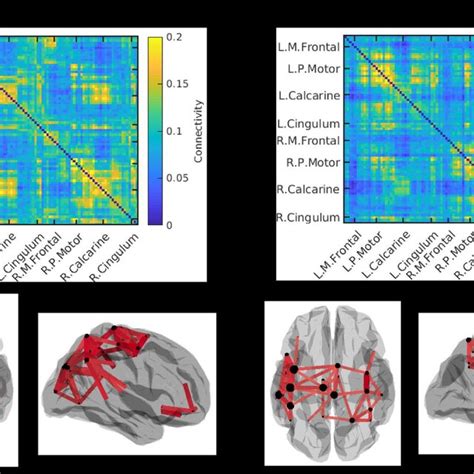 Resting State Connectivity Plots Derived From Opm Data Alpha A And Download Scientific