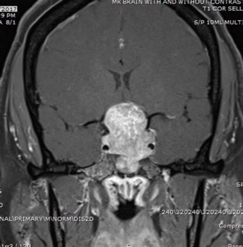 Reproduction Diseases Flashcards Quizlet