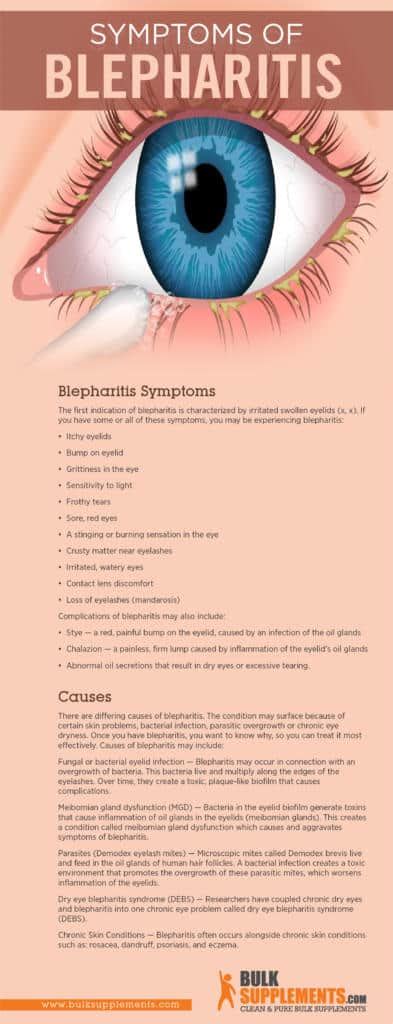 Blepharitis Symptoms Causes Treatment