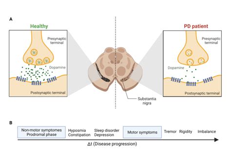 The Continuous Loss Of Dopaminergic Neurons In Snpc Leads To The