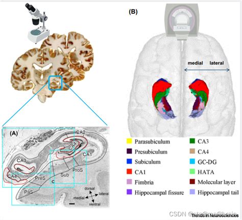 利用freesurfer6进行海马分割的环境配置和步骤，以及获取海马体积freesurfer海马亚区体积数据提取 Csdn博客
