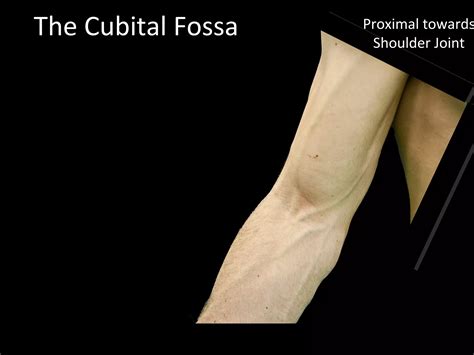 Slideshow Cubital Fossa Ppt
