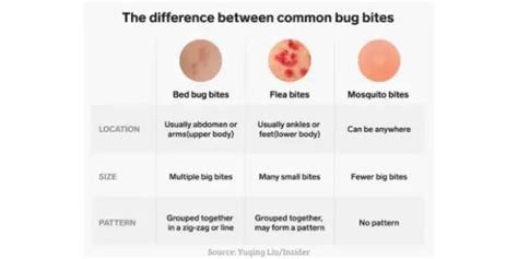 Spotting The Difference Bed Bug Bites Vs Flea Bites Unveiling The 4 Key Distinctions