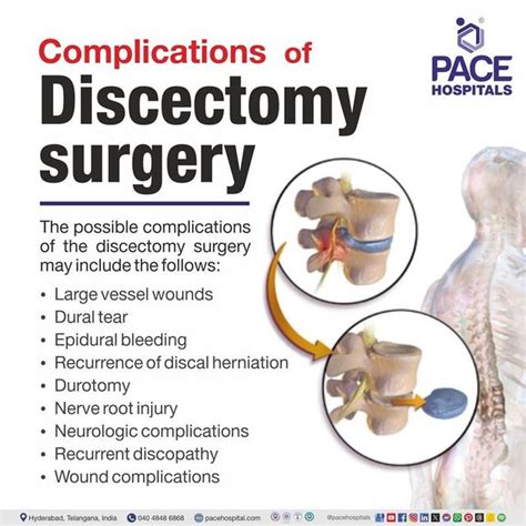 Lumbar Discectomy Complications Lumbar Microdiscectomy Conditions