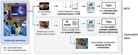 improving prototypical parts abstraction for case based reasoning