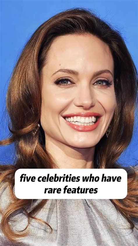 5 Celebrities Who Have Rare Featuresthe Last One Is The Most