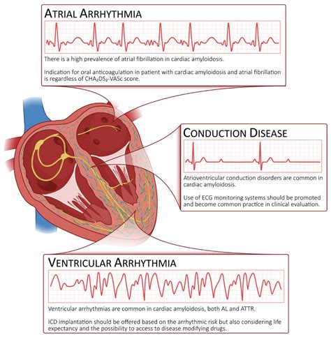 Arrhythmia Certification Course