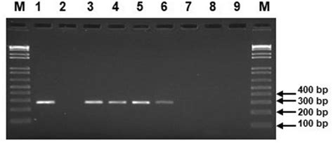 Products Of The Species Specific C Auris PCR Positive Amplification Download Scientific