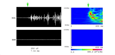 Waveforms And Spectrograms Showing The Spectral And Temporal Download Scientific Diagram