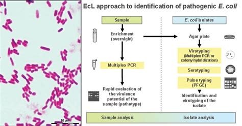 E Coli Escherichia Coli An Overview Microbe Notes
